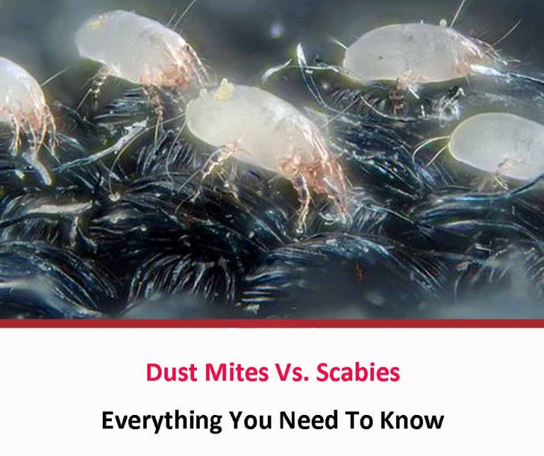 Dust Mites Vs Scabies All About Dust Mites